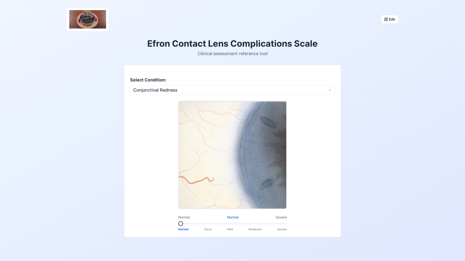 efron-eye-scale-guide